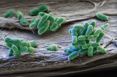 Cianobacterias o algas verdeazules (Cyanobacteria) - Escuelapedia ...
