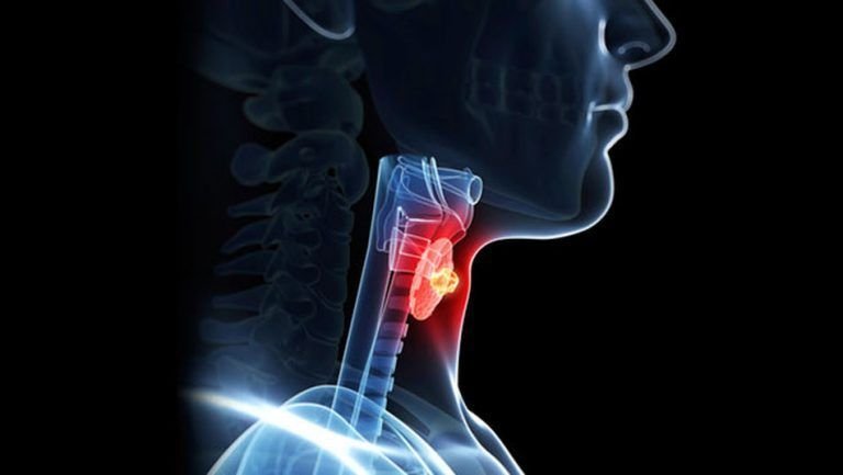 Laringe - Escuelapedia - Recursos EducativosEscuelapedia – Recursos ...