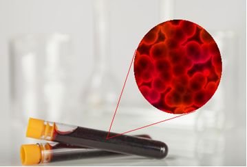 Coloides o dispersiones coloidales - Escuelapedia - Recursos Educativos